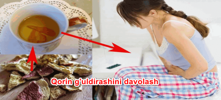Qorin g'uldirashini davolash yo'llari: foydali malhamlar